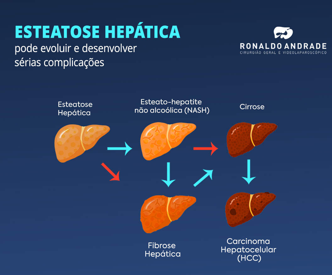 Esteatose Hepática - Dr. Ronaldo Andrade